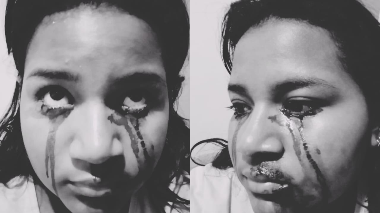 La historia de Zharick Ramírez, la adolescente que llora sangre desde ...